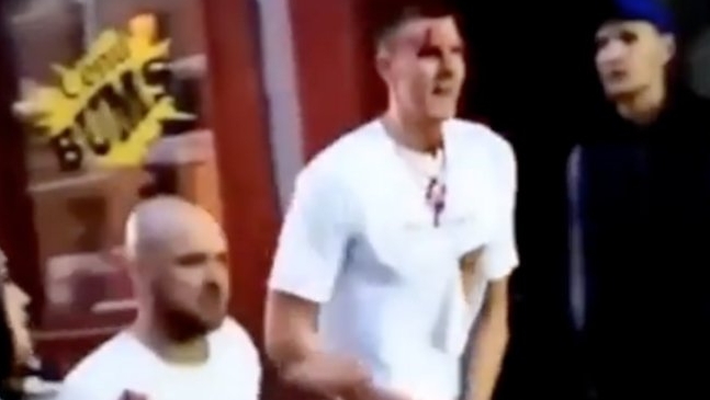 Video Shows Kristaps Porzingis Bloody With Nasty Cut Above His Eye ...