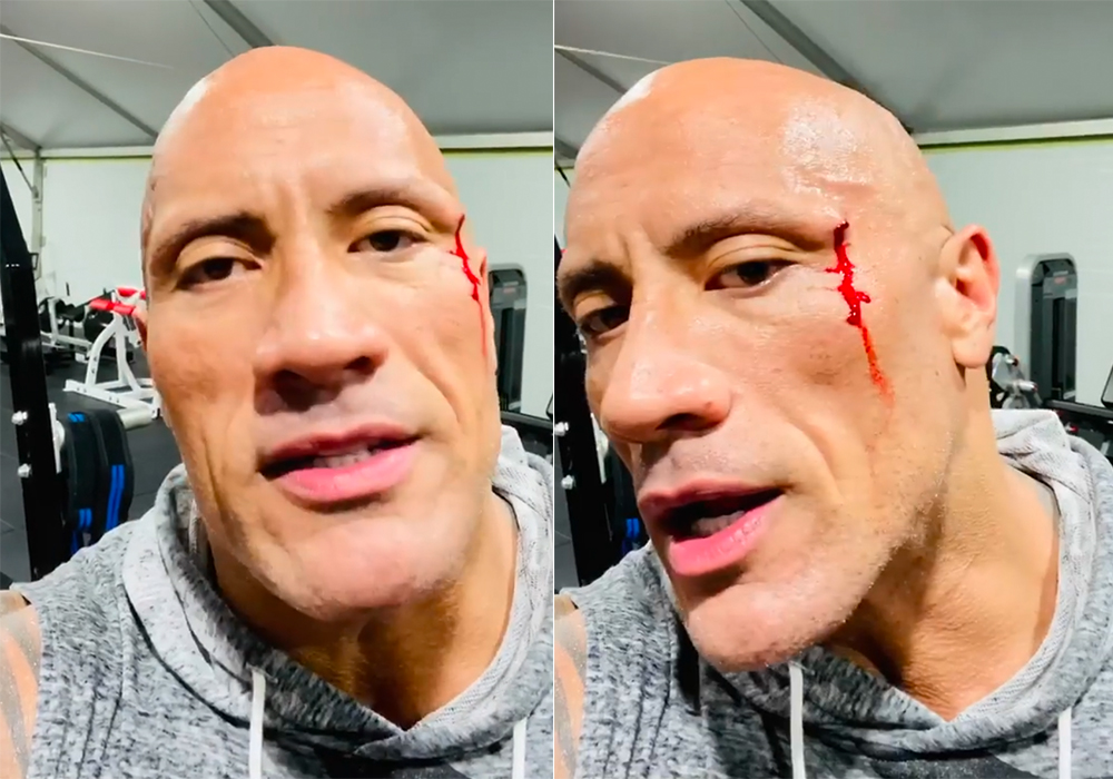 The Rock Accidentally Busts Face Open With A Chain During A Workout And ...