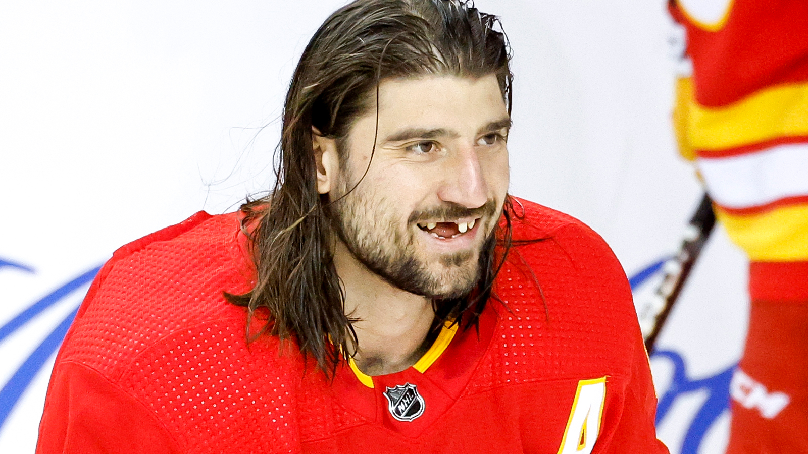Chris Tanev Has A+ Response After Blocking A Shot With His Face
