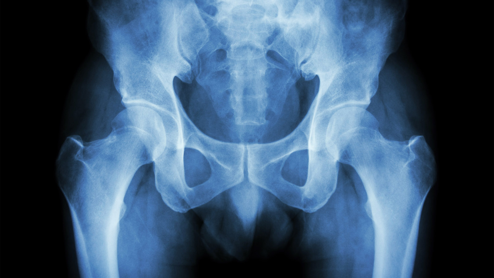 Scientists Finally Determined Why Humans Don't Have Tails