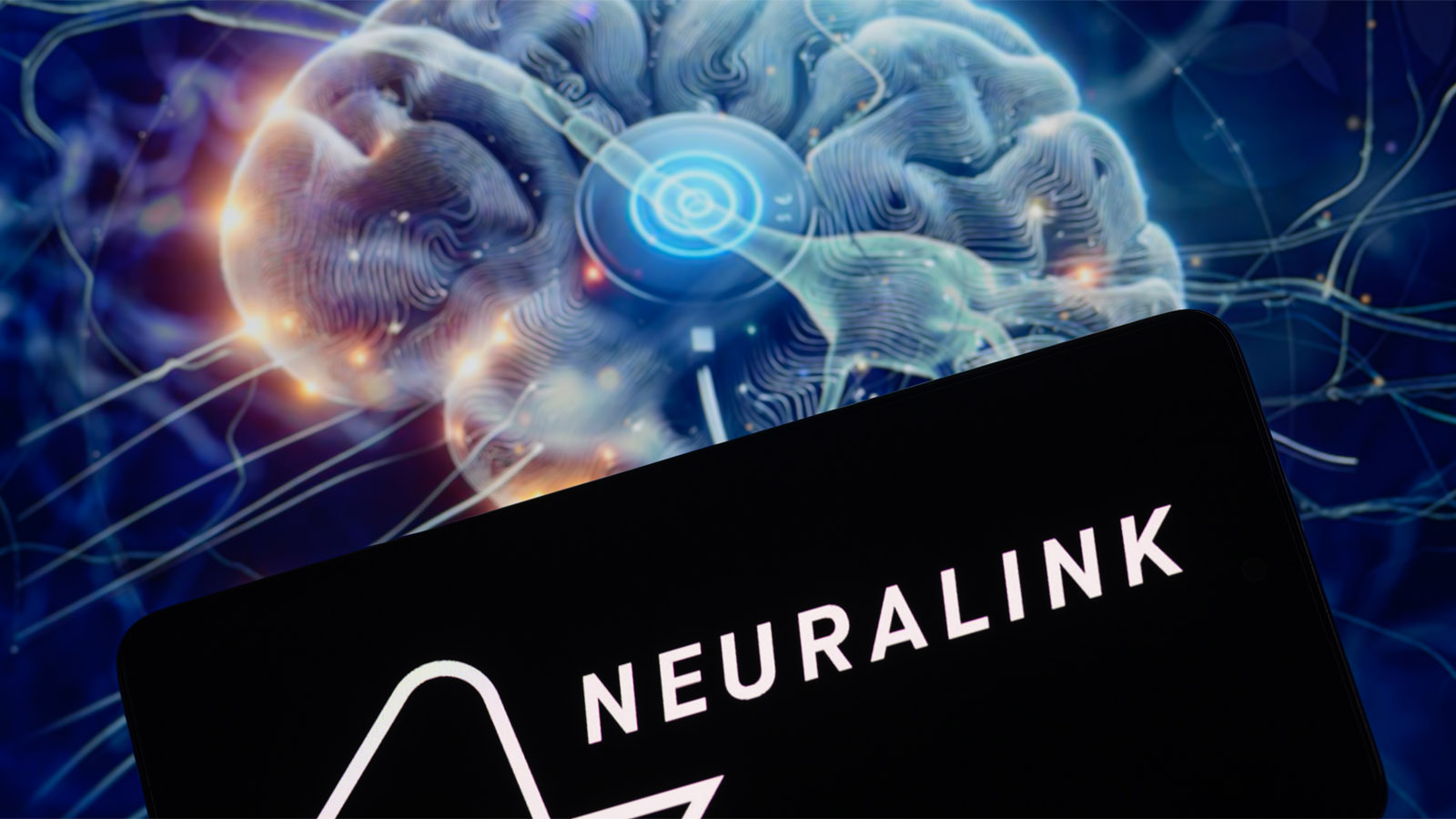 Neuralink Chip Lets Man Play 'Counter-Strike' With His Mind