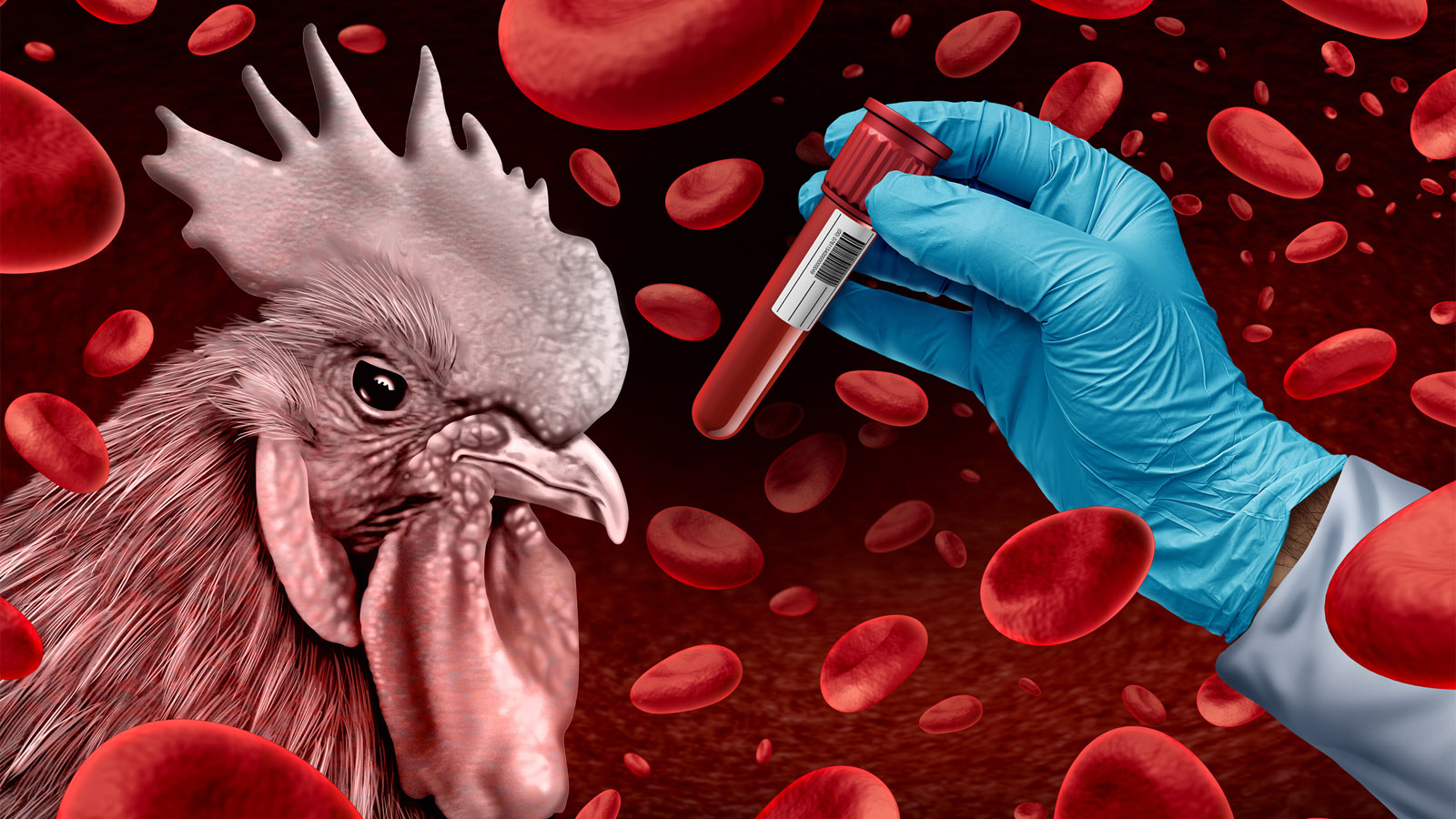 First Human Bird Flu Death In The U.S. Reported In Louisiana