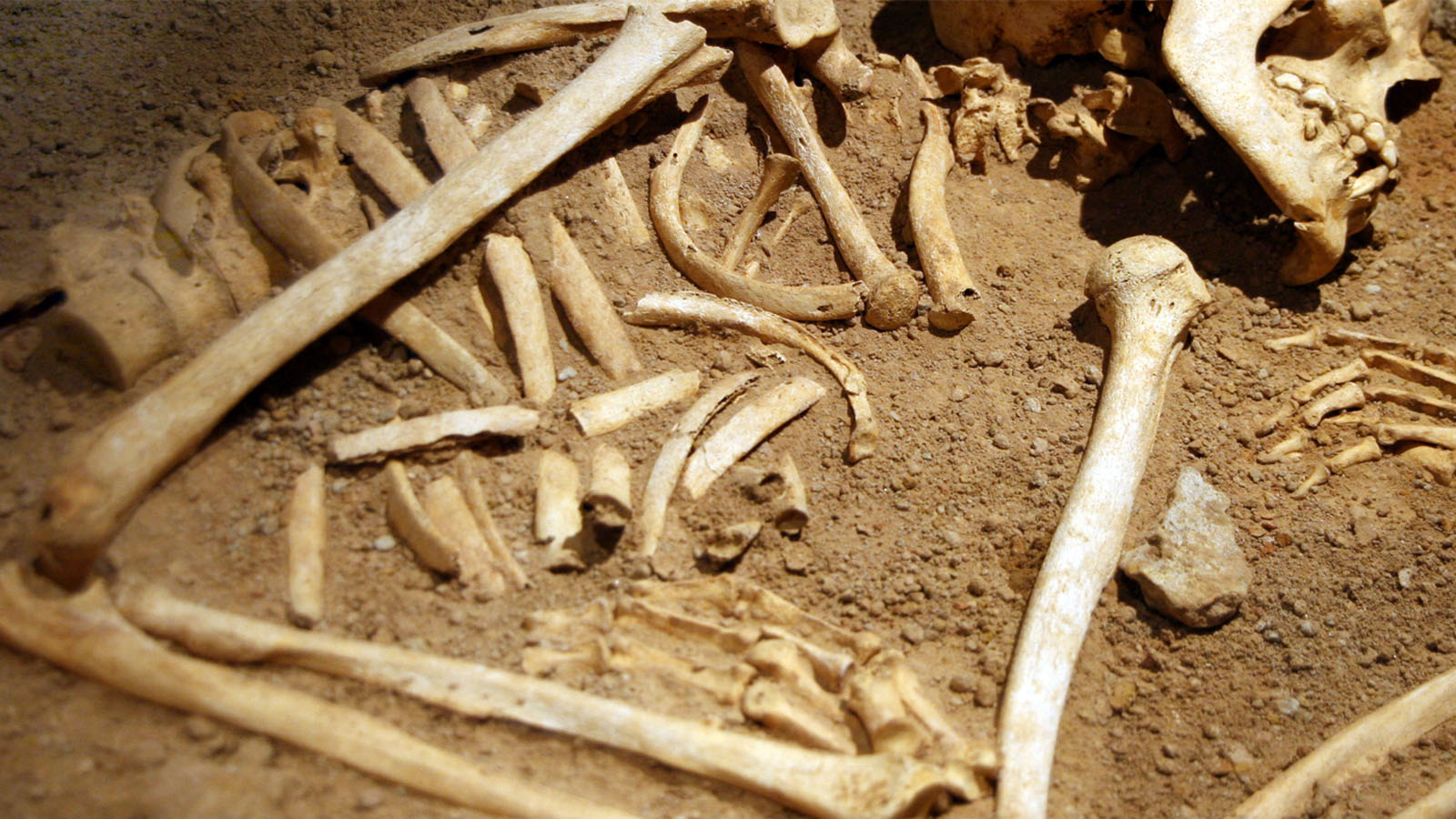 Florida Women Arrested For Selling Human Remains On Facebook