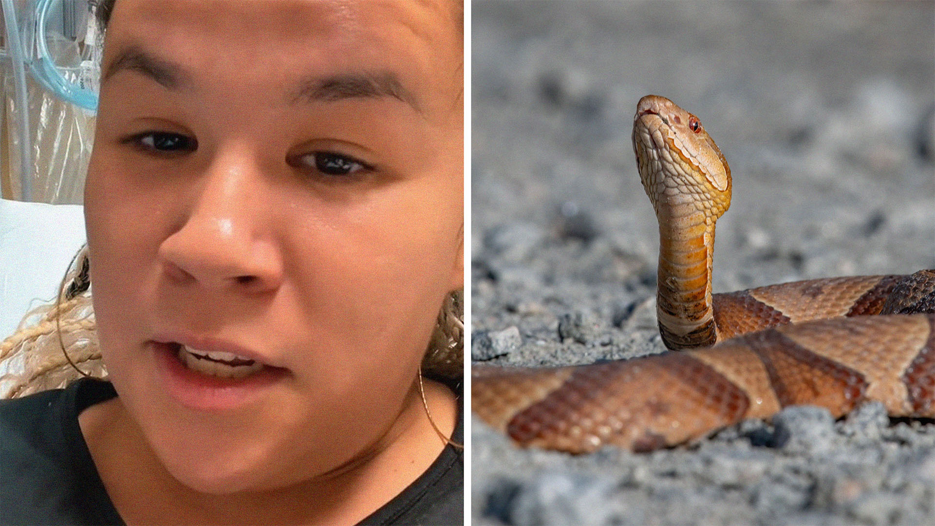 $200K Bill: Why Does Snake Bite Antivenom Cost So Dang Much?