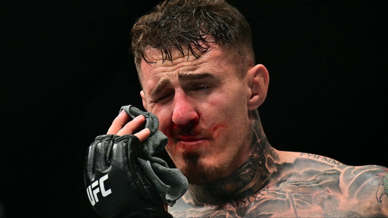 Tom Aspinall Shows Off Eye Injury After UFC 321 Eye Poke Incident
