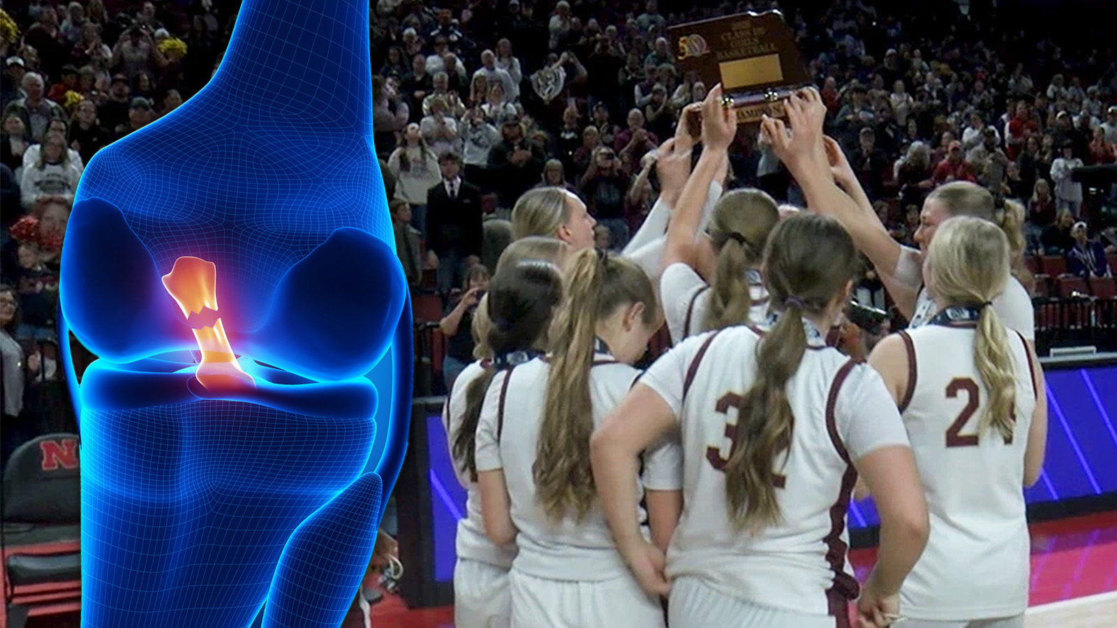 Nebraska High School Basketball Champion Plays Without A Knee